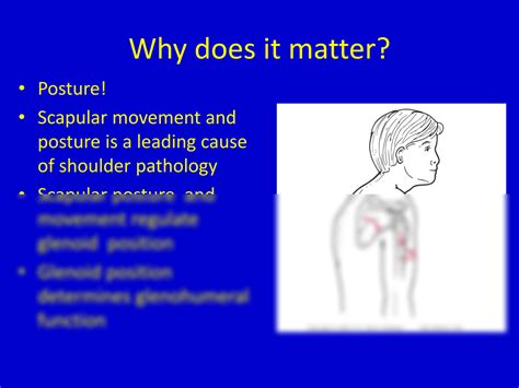 Solution Shoulder Girdle Pathology Studypool