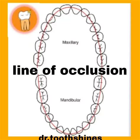 Line Of Occlusion 🟠 Dentist Malocclusion Dentistry Dentistryworld