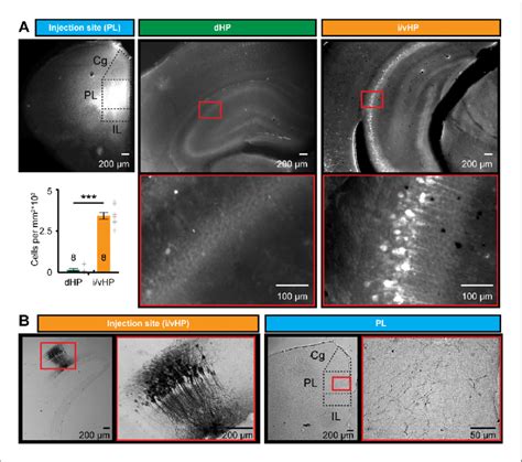Long Range Monosynaptic Axonal Projections Connecting The Neonatal Pfc Download Scientific