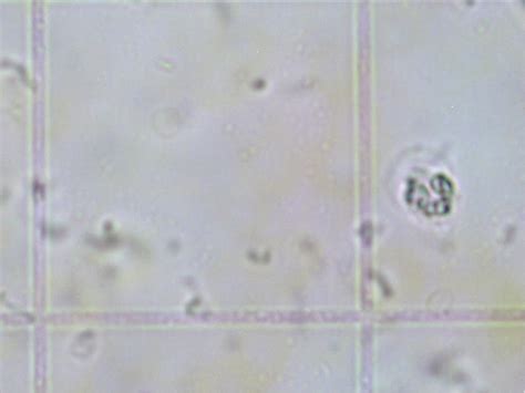 Nadi Biologi Leukosit Menghitung Jumlah Leukosit