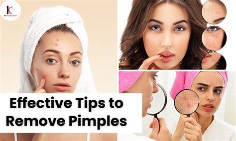 10 Proven Tips To Remove Pimples Your Complete Guide