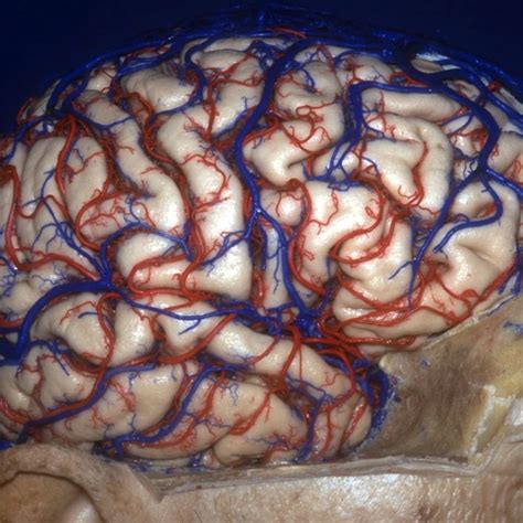Brain Real Image