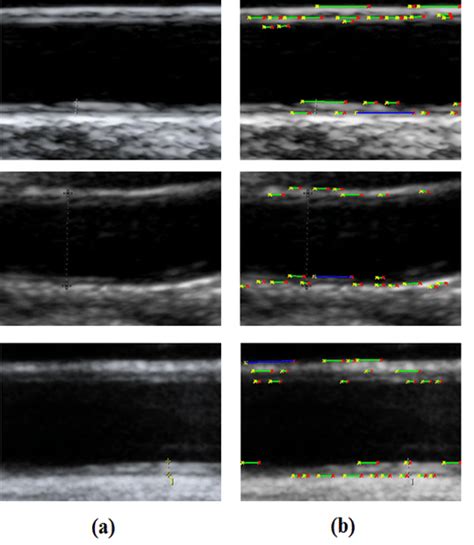 Simulated Annealing Based Optimal Threshold Detection A Original Download Scientific Diagram