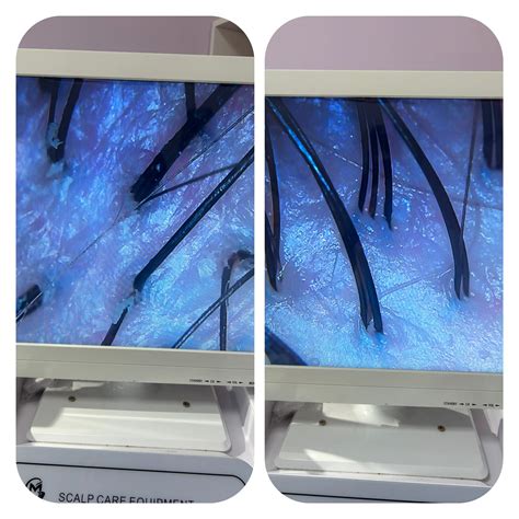 Эрүүл үс Та хуйхаа хэр зэрэг цэвэрлэдэг вэ🧐 Олон хүн Facebook