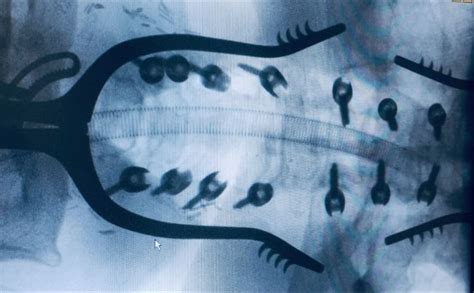 Mark Plazier Posted On Linkedin