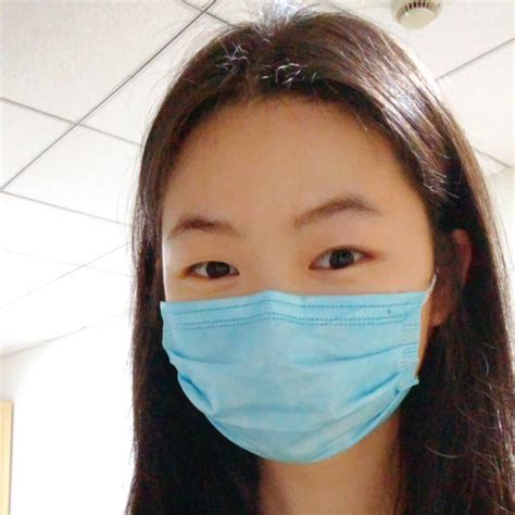 Yuting Yang Master Of Science Fudan University Shanghai Hospital Of Eye Ear Nose And