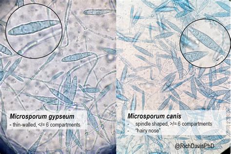 Microsporum Gypseum