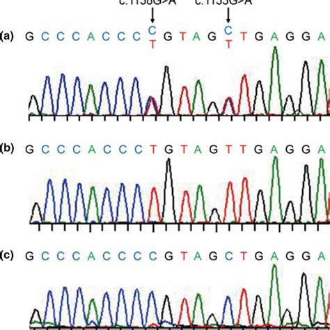 Sanger Sequencing Of The Proband In The Region About The Mutations In Download Scientific