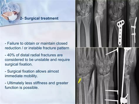 Fractures Of The Distal Radius Ppt