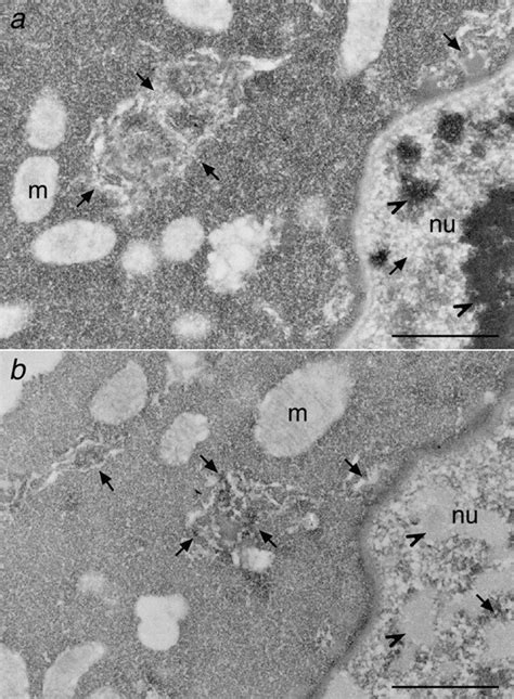 Rna Staining Of Wild Type Stage 9 Nurse Cells A Electron Micrograph