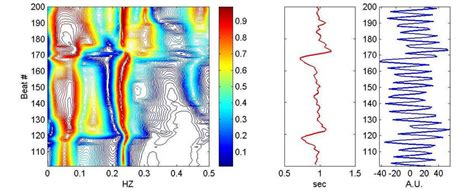 Squared Coherence Function For Rr Intervals And Respiration Top Figure