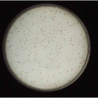 PDF Interactive Automated Method To Count Bacterial Colonies