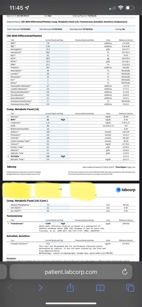 Lab Results R Testosterone Lab Results R Testosterone