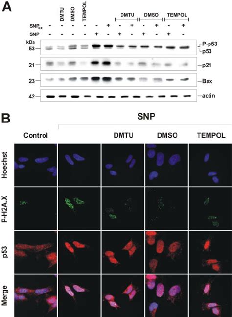 P53 Activation Is Responsive To Snp Induced Ros Production And Download Scientific Diagram