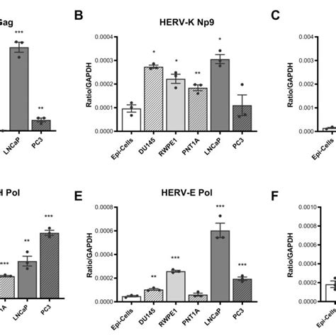 HERV Transcript Expression In Prostate Cancer Cell Lines And Primary