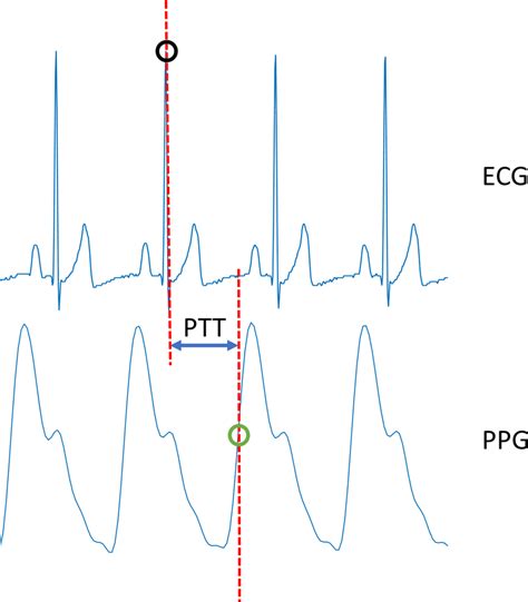 Illustration Of Pulse Transit Time Calculation Pulse Transit Time Is
