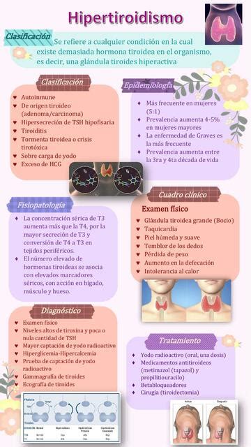 Hipertiroidismo Aldo Giovanni Udocz