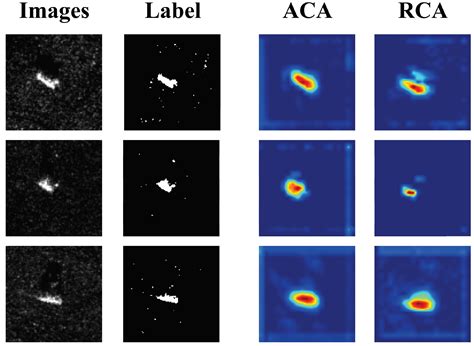 complementary view sar target recognition based on one shot learning
