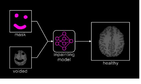 Figure 1 From The Brain Tumor Segmentation Brats Challenge 2023