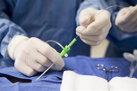 Катетеризация периферических вен: преимущества и недостатки методики