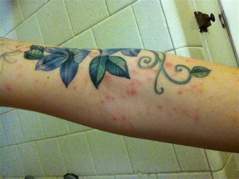 Red Rash Tattoos