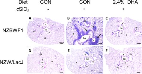 DHA Supplementation Prevents CSiO2 Induced Pneumonitis Representative
