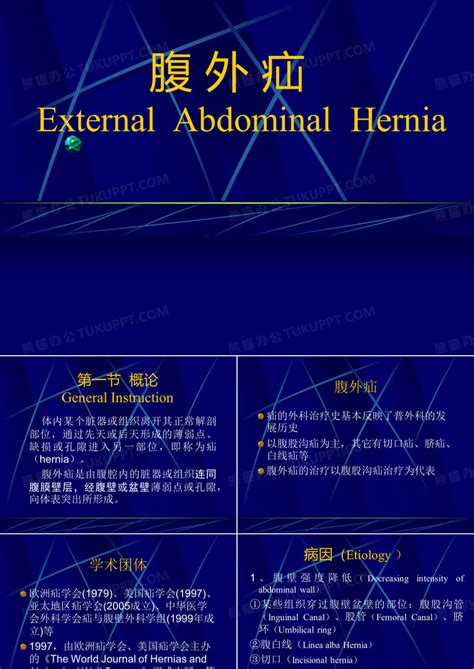 腹股沟疝PPT模板下载 编号lnnvdnrj 熊猫办公