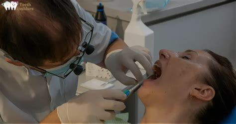 Do You Always Need A Crown After A Root Canal