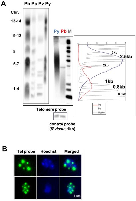 A Determination Of Telomere Length By Telomere Restriction Fragment Download Scientific
