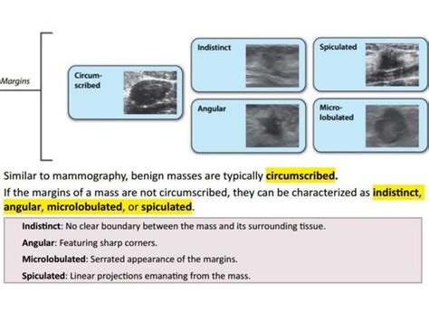 Birads Breast Ultrasound Mamography Pptx