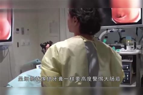 放屁很多是“大肠癌”吗？消化科医生：上厕所时要注意这4种信号厕所医生信号