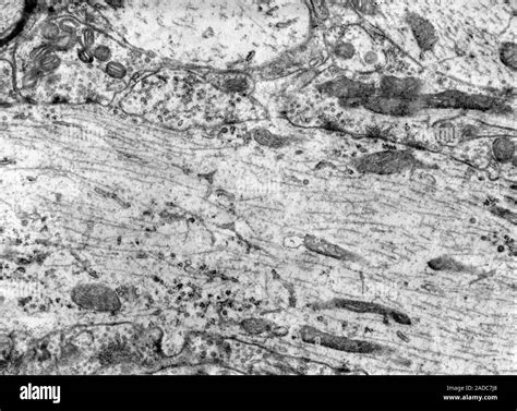 Transmission Electron Micrograph Tem Showing A Dendrite Surrounded By