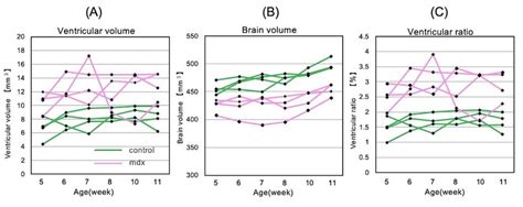 The Ventricular Volume Transition A Whole Brain Volume Transition