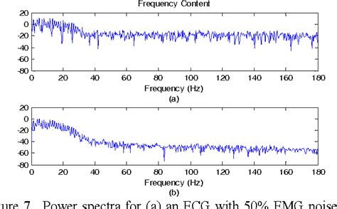 Figure From Cancellation Of High Frequency Noise In ECG Signals Using Adaptive Filter Without