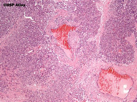 Hsp Atlas Histopathology Atlas Heart And Vessels