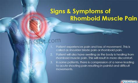 Rhomboid Muscle Pain Causes Symptoms Treatment Relief Exercises