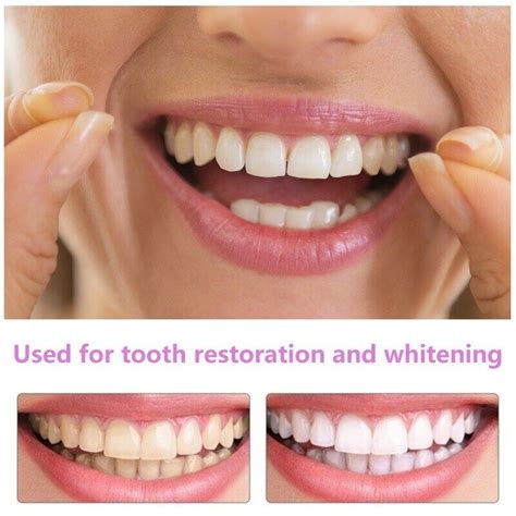 2 Pcs Silica Material Temporary Upper Lower Teeth Simulation Cover