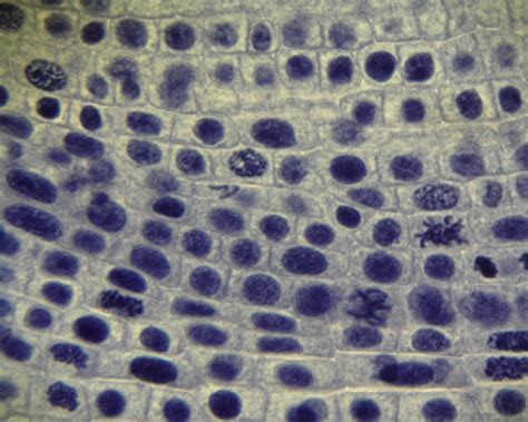 Allium Root Tip Stained For Mitosis Learning Space Solutions