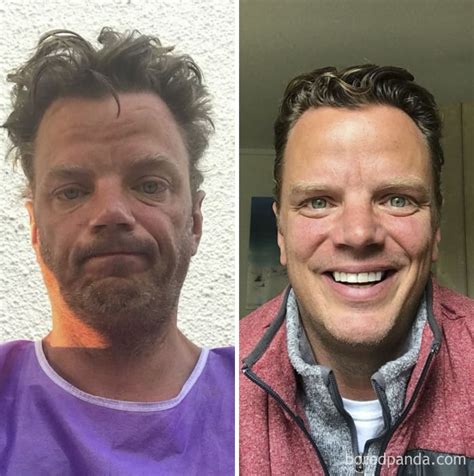 Alcohol Before And After