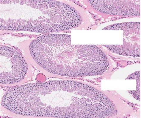 Male Histology Lab Practical Flashcards Quizlet