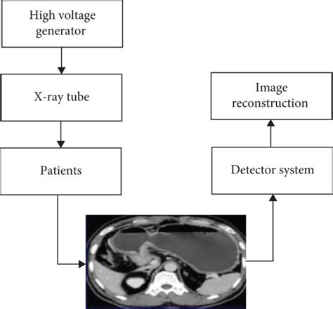 Schematic Diagram Of The Data Flow Of Ct System Imaging Download