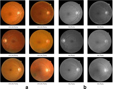 Image Samples Of The Messidor Dataset A Colorful Samples B Gray Samples Download Scientific