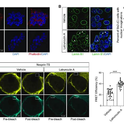 Latrunculin A Induced Depletion Of F Actin Reduces Nuclear Tension In Download Scientific