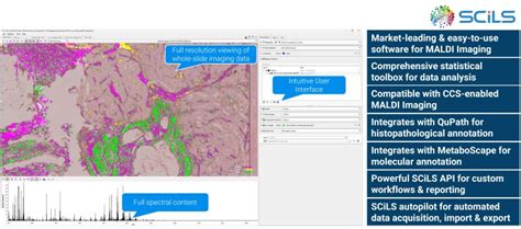 Bram Heijs On Linkedin Asms2024 Scilslab