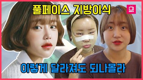 풀페이스 얼굴지방이식 1차후기 얼굴성형 이 좋은 걸 왜 안해 얼굴지방이식얼굴지방흡입듀얼트임앞트임입체적인 페이스가 돋보이는 러블리얼굴로 변신 쀼
