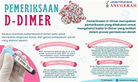 Pemeriksaan D Dimer Laboratorium Klinik Anugerah