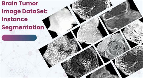 Brain Tumor Image Dataset Instance Segmentation