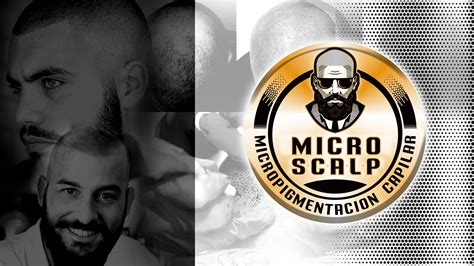 Micro Scalp Innovation Love The Shaved Look You Can Now Get The Look