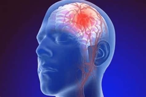 Stroke Prediction With Machine Learning