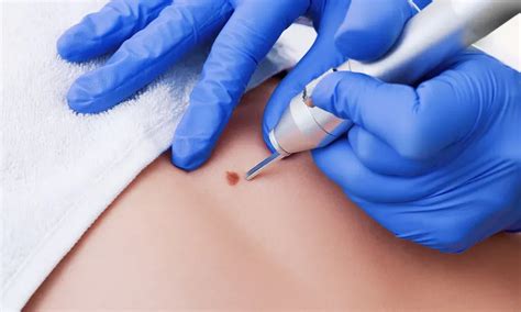 Luminary Dermatology Dermatology Aesthetics Plastic Surgery And Mohs